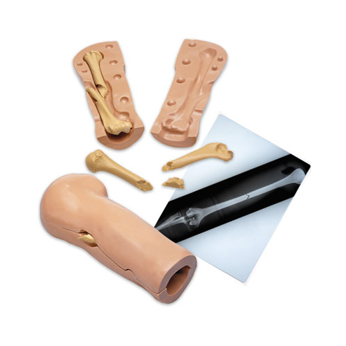 Life/form Imaging Fracture Simulator