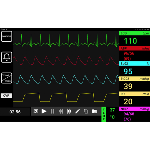 Life/form Lucy SimVS OB Delivery Simulation System offers a near real ...