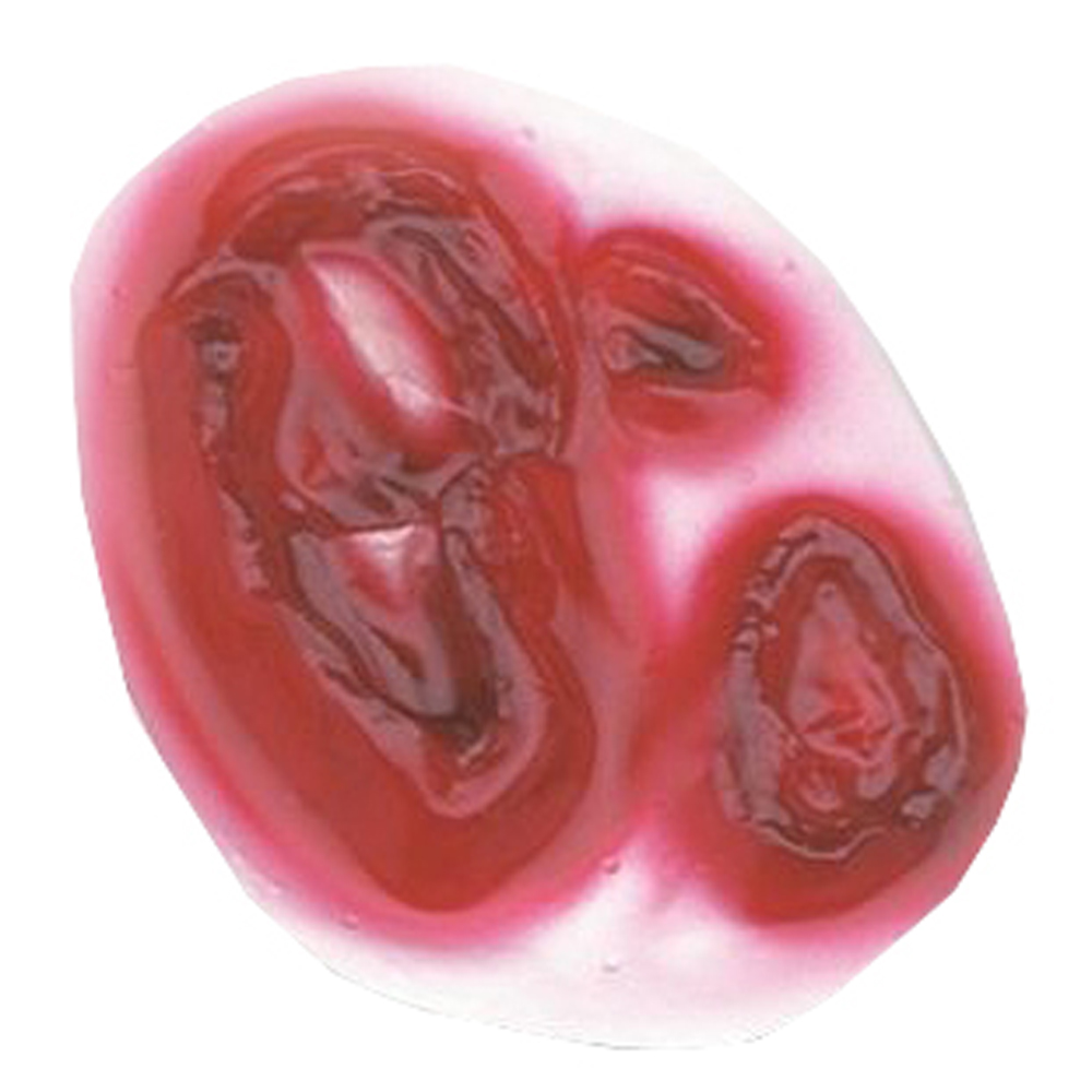 Simulaids Compound Fracture Tibia Stick-On
