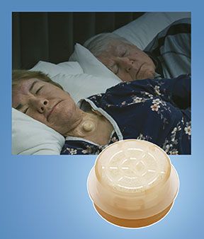 Blom-Singer Day&Night HME (Heat Moisture Exchange) System