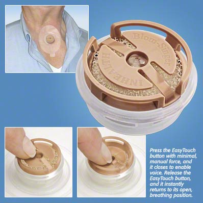 Blom-Singer HME (Heat Moisture Exchange) System