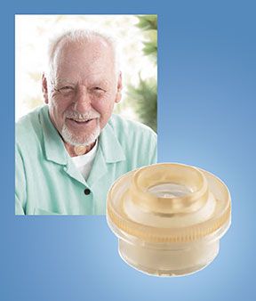 Blom-Singer SpeakFree HME (Heat Moisture Exchange) System