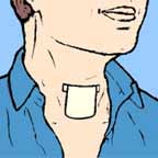 Laryngectomy and Tracheostomy Filters and Covers