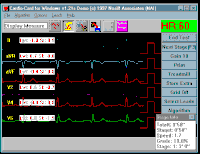 CARDIOCARD PC-BASED EKG SYSTEM FROM $1895