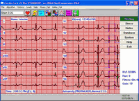 COMPUTER BASED EKG AND STRESS
