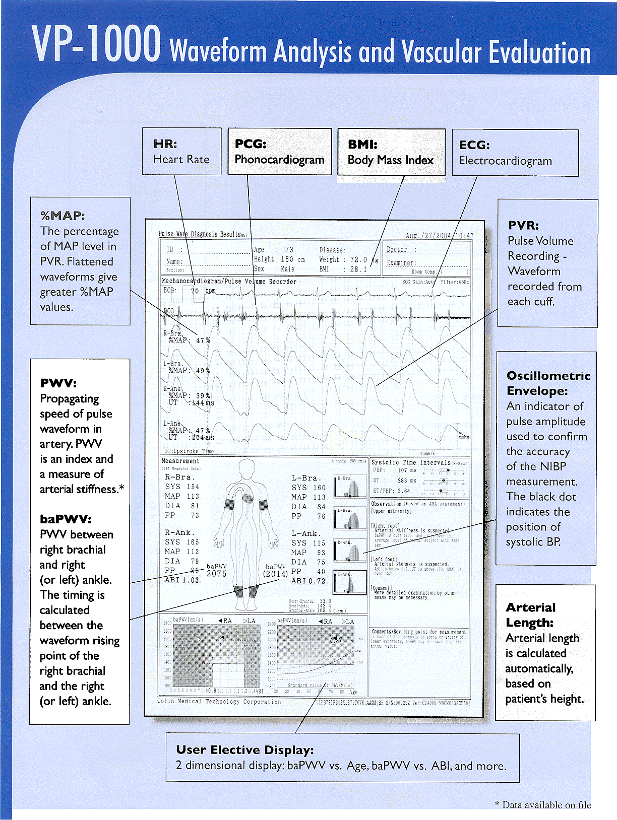 VP-1000 PAD Vascular Profiling System