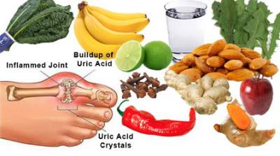 Gout Foods to Avoid | Gout Diet | Purines Chart | Uric Acid Chart