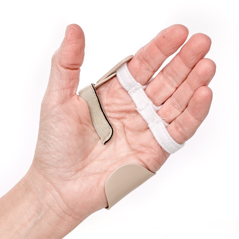 3PP Radial Hinged Ulnar Deviation Finger Splint: #1 Fast Free Shipping ...
