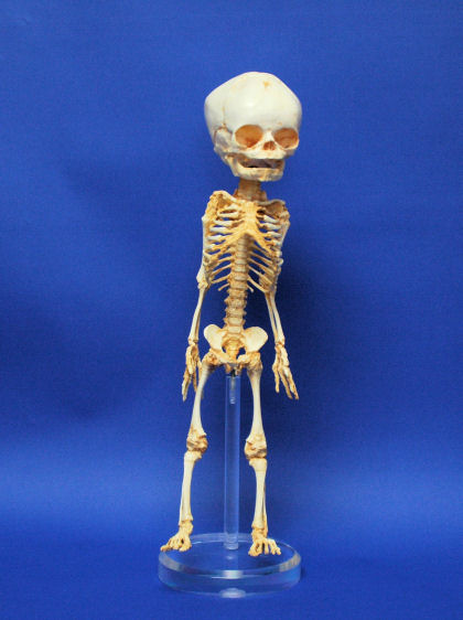 Human Baby Skulls