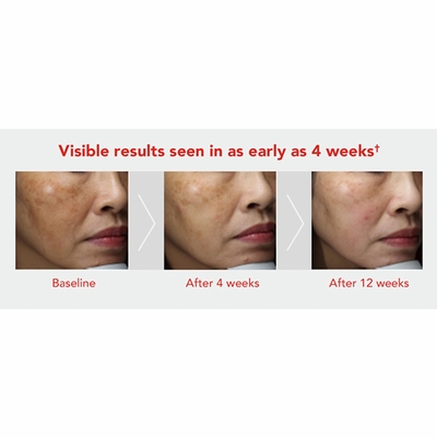 Cyspera Intensive Pigment Corrector