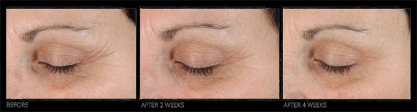 MEG 21 Bright & Firm Eye Treatment