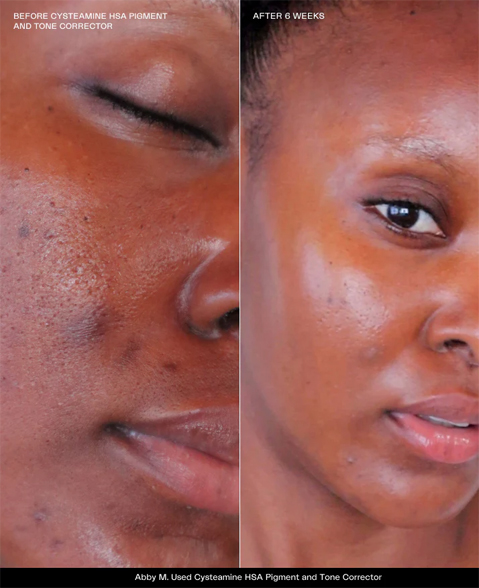 Sente Cysteamine HSA Pigment & Tone Corrector