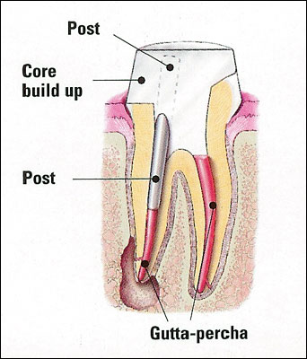 DENTAL CORE