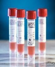 Universal Viral Transport Kit Includes: 3mL Vial with Flexible Minitip ...