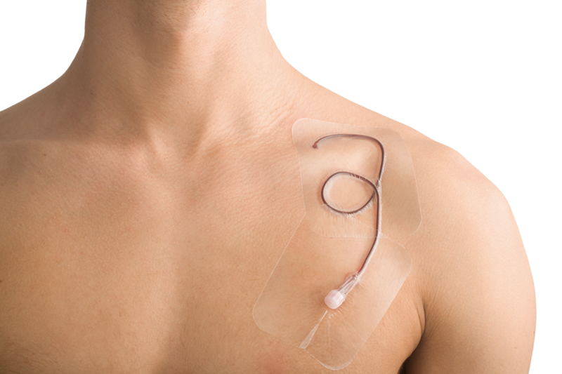 Leukomed T Transparent Film Wound Dressings by BSN Medical