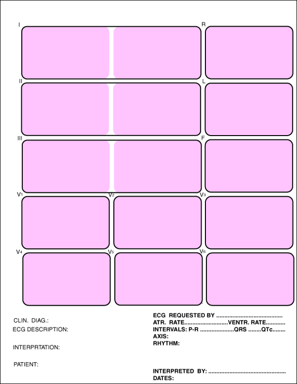 Beck-Lee EKG Mount (2441) | ECG Supplies
