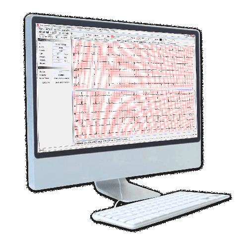 Bionet CardioTouch 3000 EKG Machine - Economical, Reliable and High ...