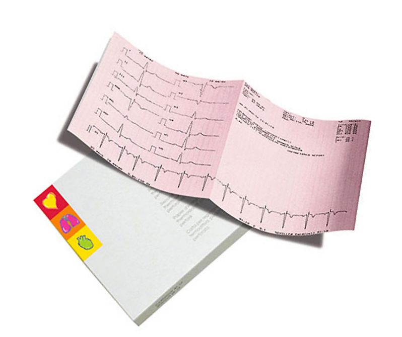 Chart Paper for Schiller FT-1 Tablet EKG Machine (2.157037) | Beck-Lee