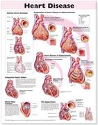 "HEART DISEASES" LAMINATED ANATOMICAL CHART | Beck Lee
