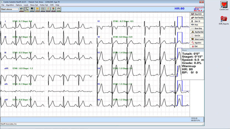 Nasiff CardioStress PC Based Stress ECG System | Beck-Lee