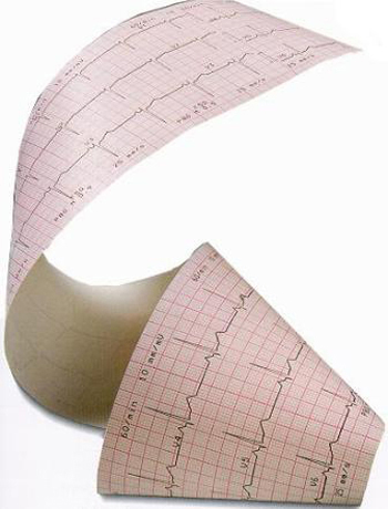 OP-69TE Fukuda Roll EKG Chart Paper | Beck-Lee