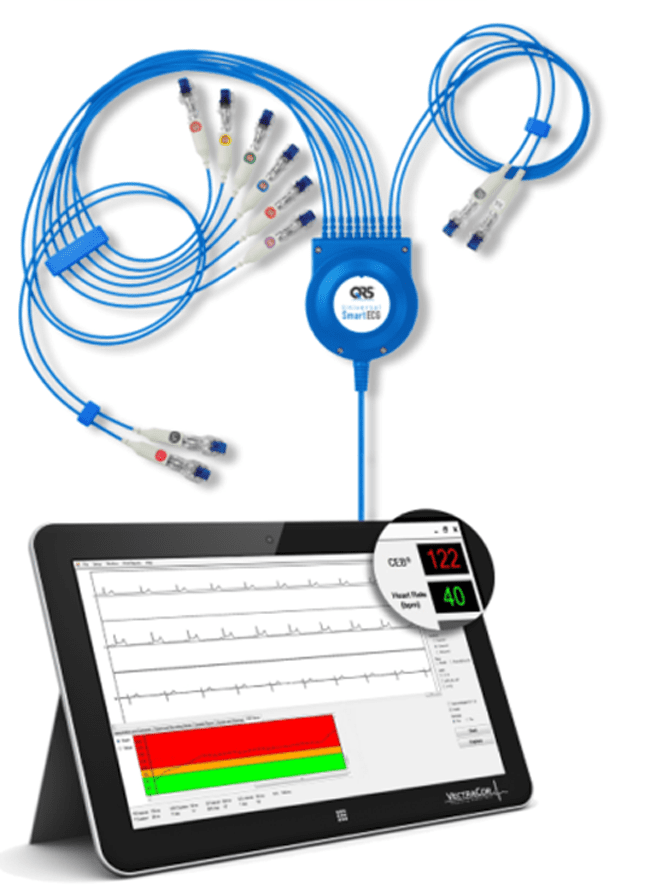 QRS Vectracor SmartECG Machine | Beck-Lee