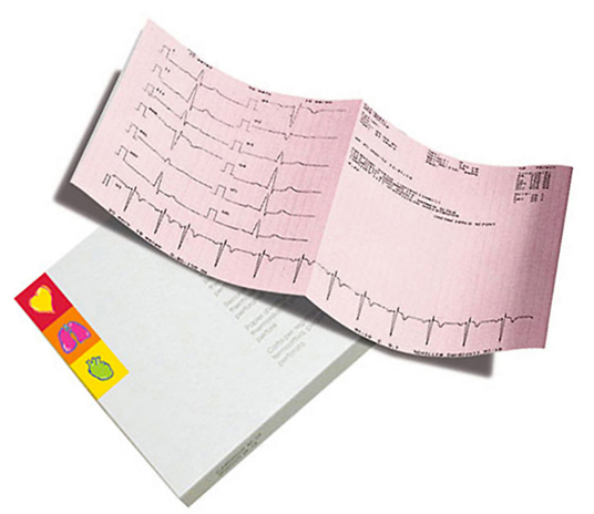 Schiller MS-2010 EKG Chart Paper (2.157035C) | Beck-Lee