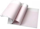 Welch Allyn ECG Chart Paper | Beck-Lee