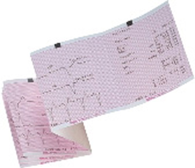 Burdick Fetal Monitor Chart Paper | OBGYN Supply