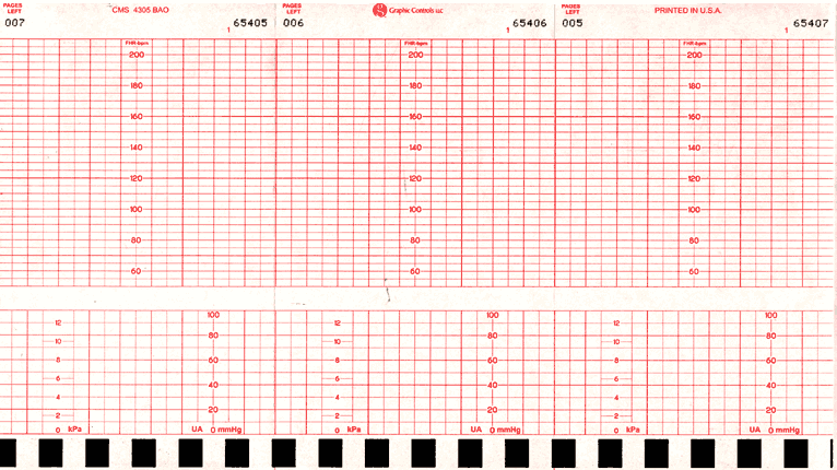 Fetal Monitoring Paper Corometrics G.E. 4305BAO | OBGYN Supply