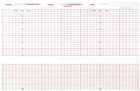 Fetal Monitoring Paper Corometrics G.E. 4305BAO | OBGYN Supply