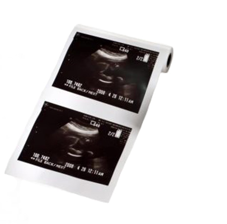 Sony Generic Ultrasound Imaging Paper | OBGYN Supply
