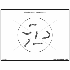 Streptococcus Pneumoniae Diagram