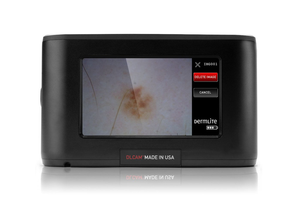 3GEN Dermlite Foto Camera System for Dermascopy Prices