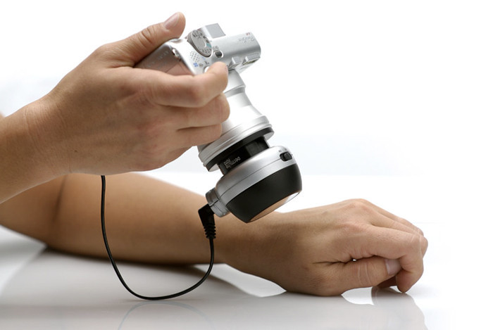 3GEN Dermlite Foto Dermascopy System Prices