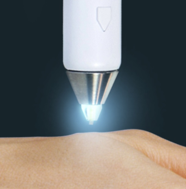 CryoLab Medical Cryosurgical Device | CryoConcepts