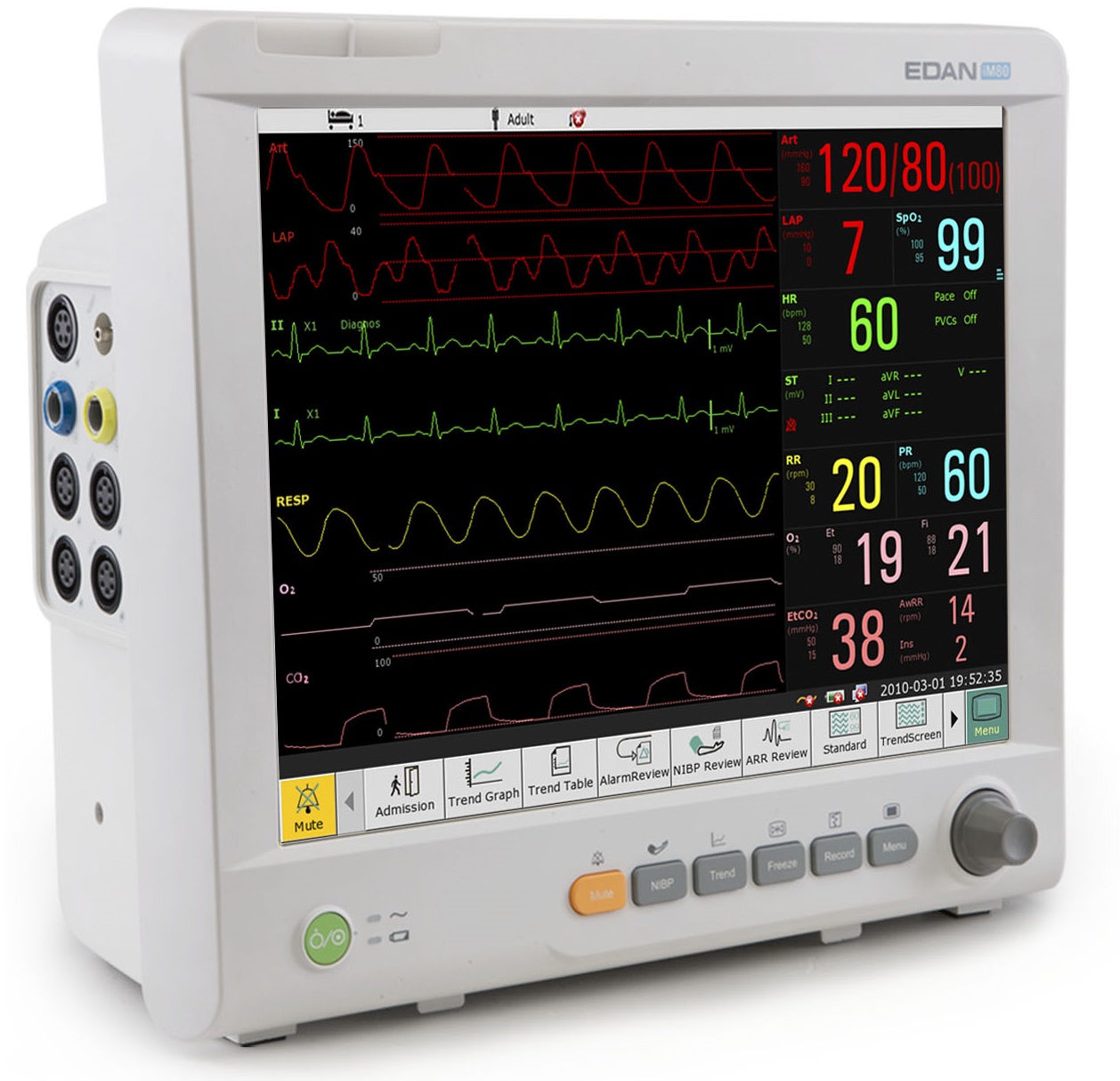 EDAN IM80 Patient Monitor | ECG, NIBP, SpO2, Resp., Temp., *ETCO2, IBP ...