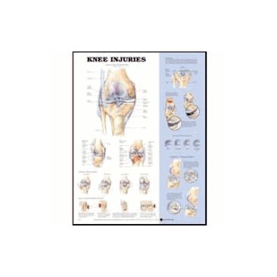 Anatomical Chart Knee - Chart, Anatomical KneE Injury - Anatomical ...