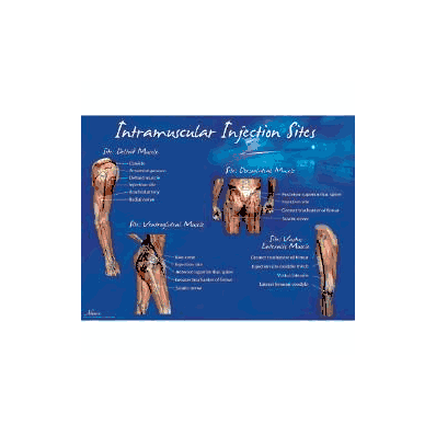 Intramuscular Injection Sites Training Poster, 18" x 24" Laminated ...