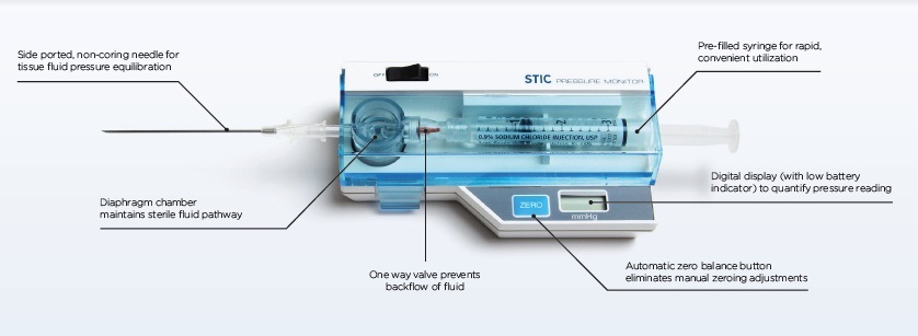 STIC Intra-Compartmental Pressure Monitor unit Stryker, C2DX Stryker ...