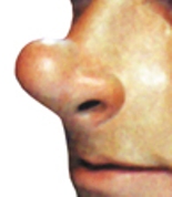 Fairytale Dwarf Nose - Glue On - PROSTHETIC NOSES