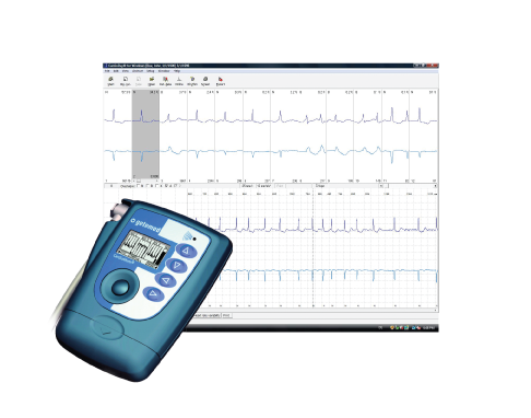 Holter Monitoring System:GE CardioDay Software | Physician's Resource