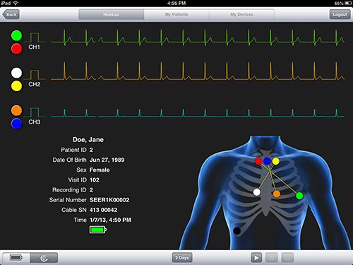 Holter Monitoring System:GE SEER 1000 | Physician's Resource