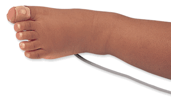 Nellcor Infant Adhesive SpO₂ Sensor - rentals