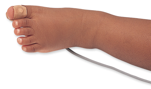 Nellcor Pediatric/Infant Reusable SpO₂ Sensors with Wraps - rentals